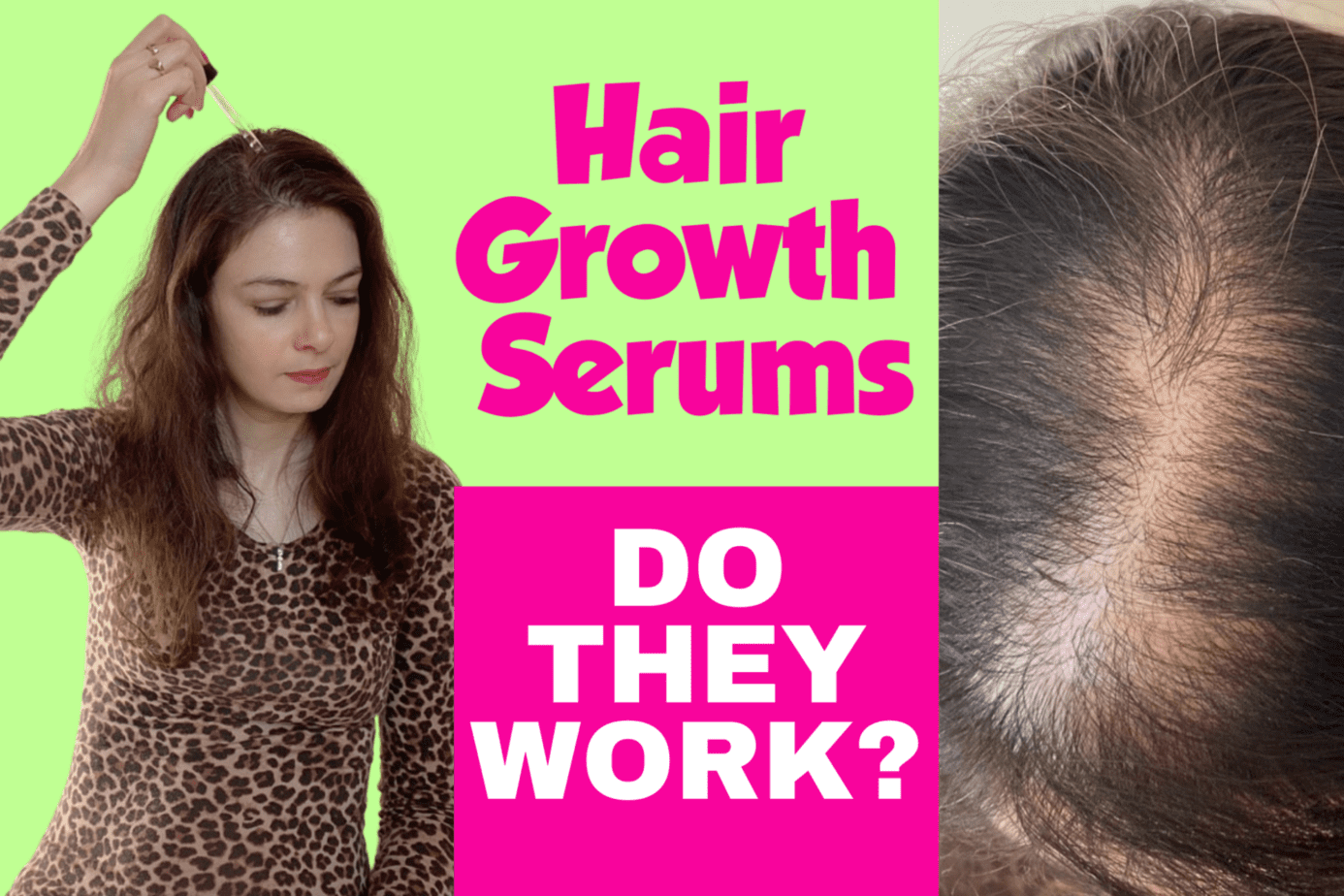 Grow Gorgeous Hair Growth Serum Review - Does it Work?
