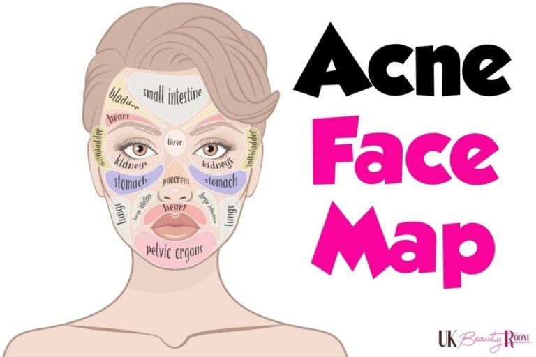 Acne Face Map: What Your Acne is Telling You About Your Health