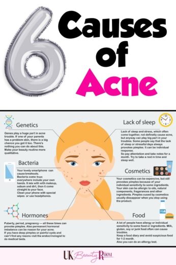 Acne Face Map: What Your Acne is Telling You About Your Health
