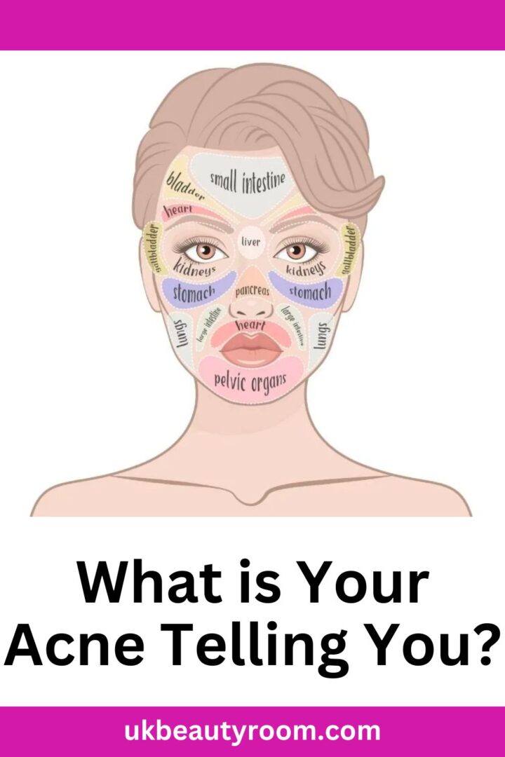 Acne Face Map: What Your Acne is Telling You About Your Health